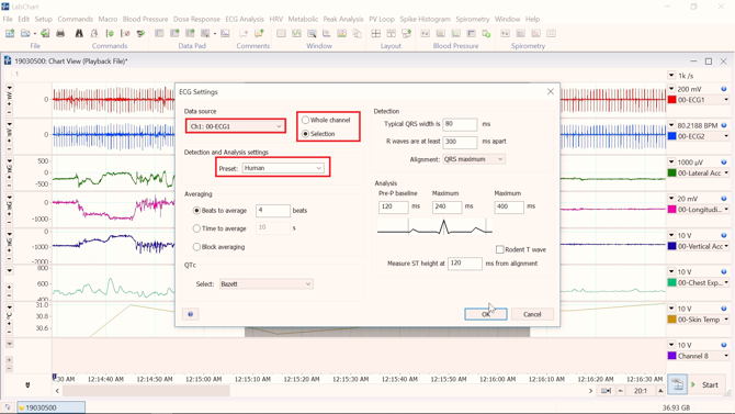 Analyzing Equivital physiological data in LabChart | ECG analysis | ADI